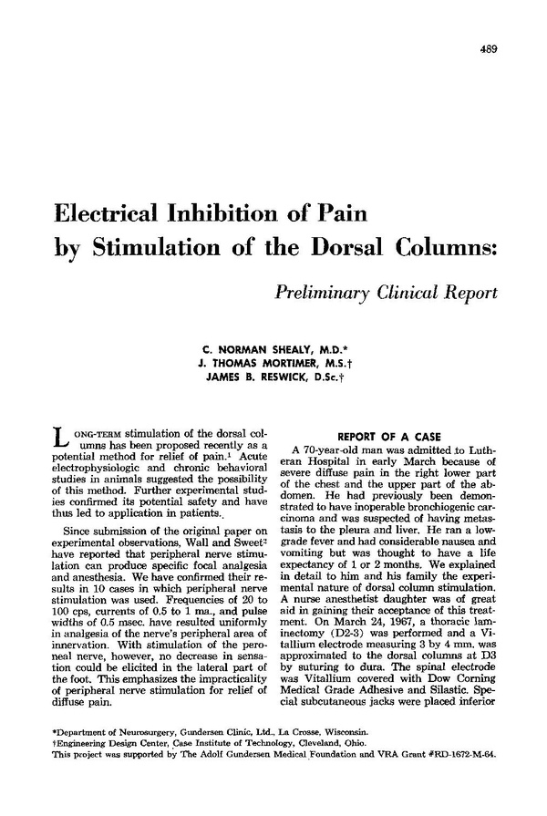 Spinal Cord Stimulation - WikiAnesthesia