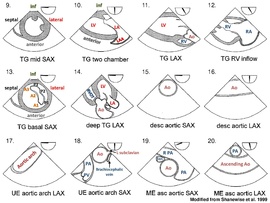 File:TEE-20views.pdf - WikiAnesthesia
