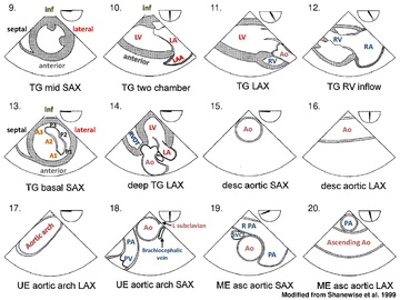 File:TEE-20views.pdf - WikiAnesthesia